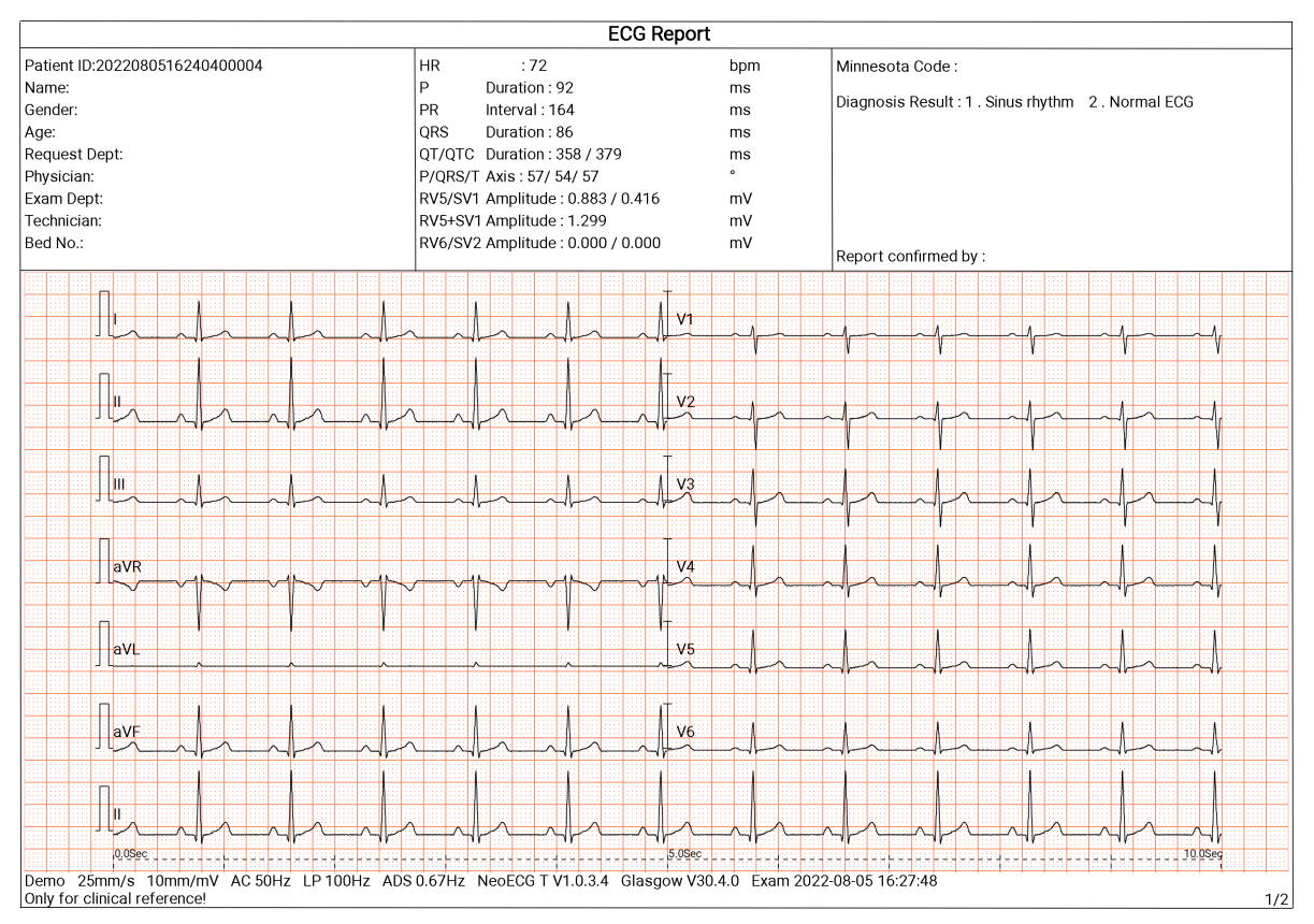 12-Lead Pocket ECG Machine – MDcubes